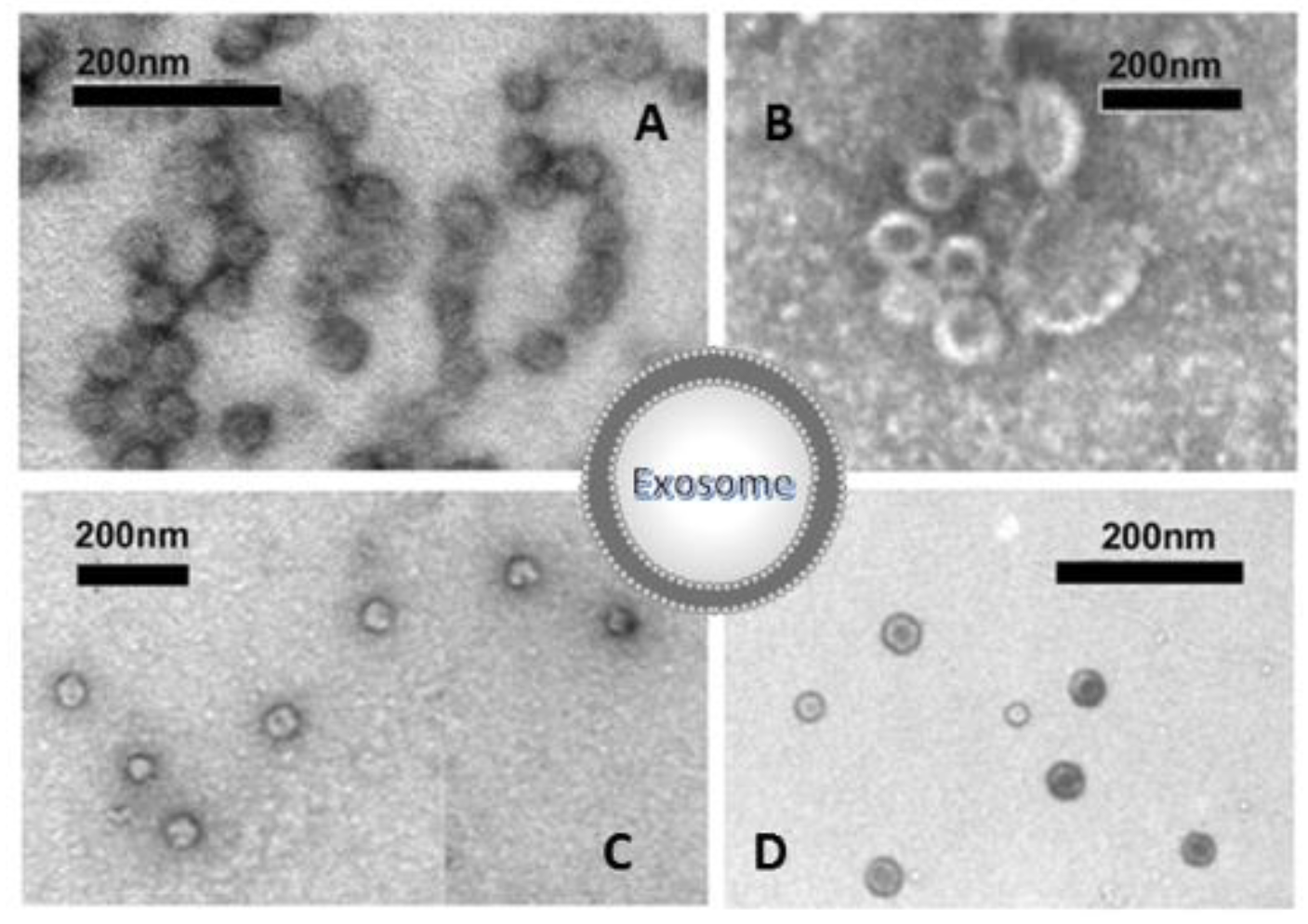 TEM-Based Exosome Identification Service | MtoZ Biolabs